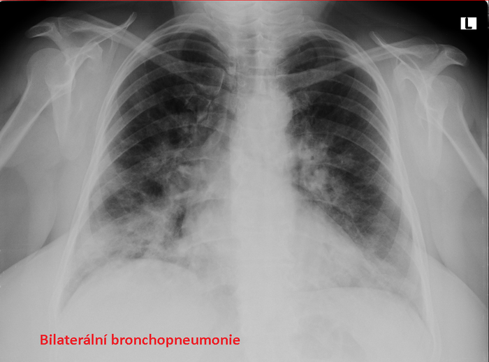 RTG atlas :: Priprava-k-atestaci-z-vnitrniho-lekarstvi
